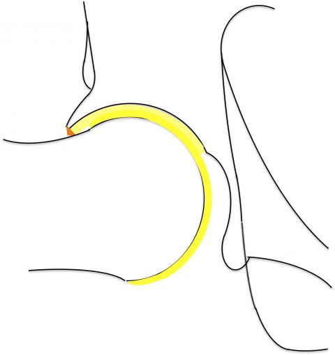 Hip Arthroscopy - The London Hip Practice